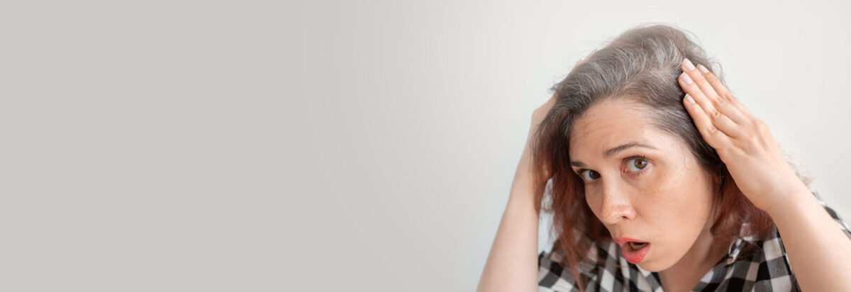 Premature Graying Treatment in Bangalore - Dr. Health Clinic